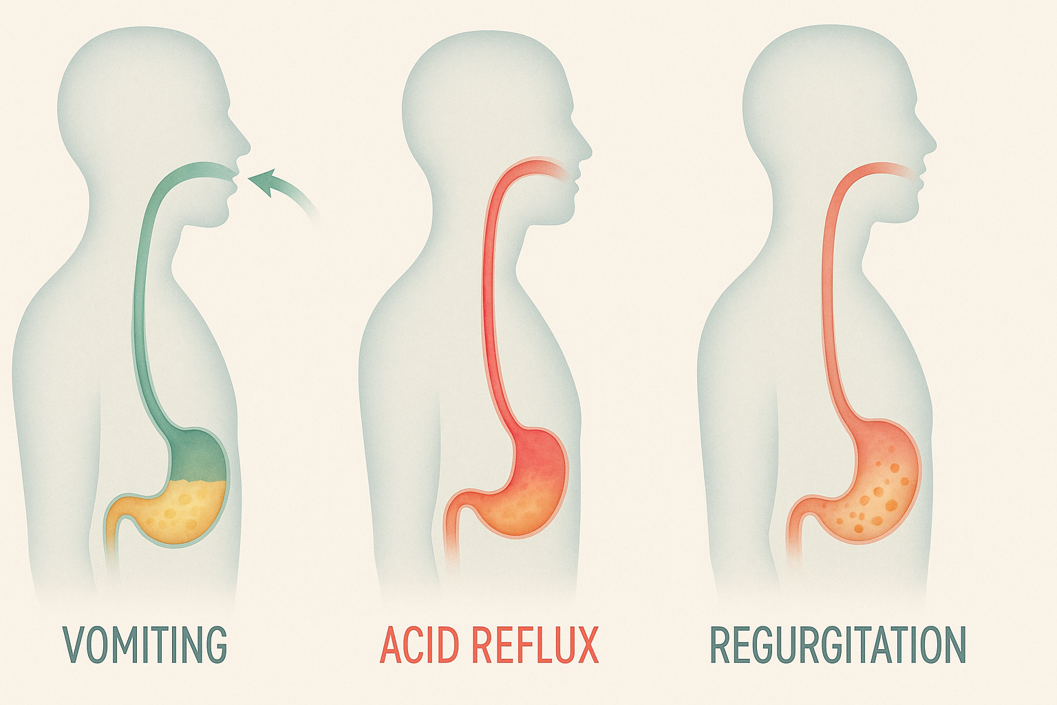 Surprising Causes of Regurgitation You Shouldn’t Ignore: What Causes ...